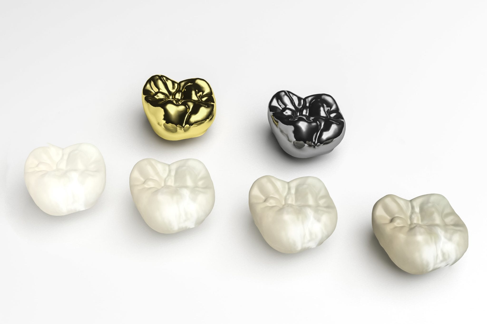 Crowns and Bridges - Formica Family Dental Practice - Hemet Dentist